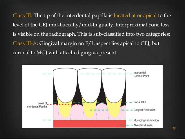 Gingival recession classifications