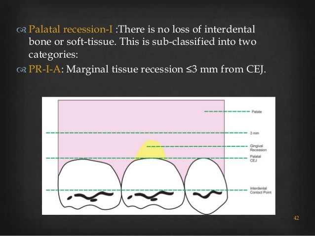 Gingival recession classifications