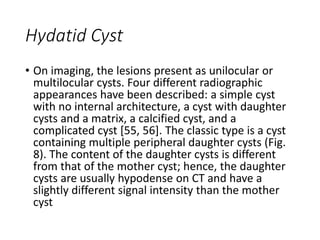 Cystic hepatic lesions | PPTX