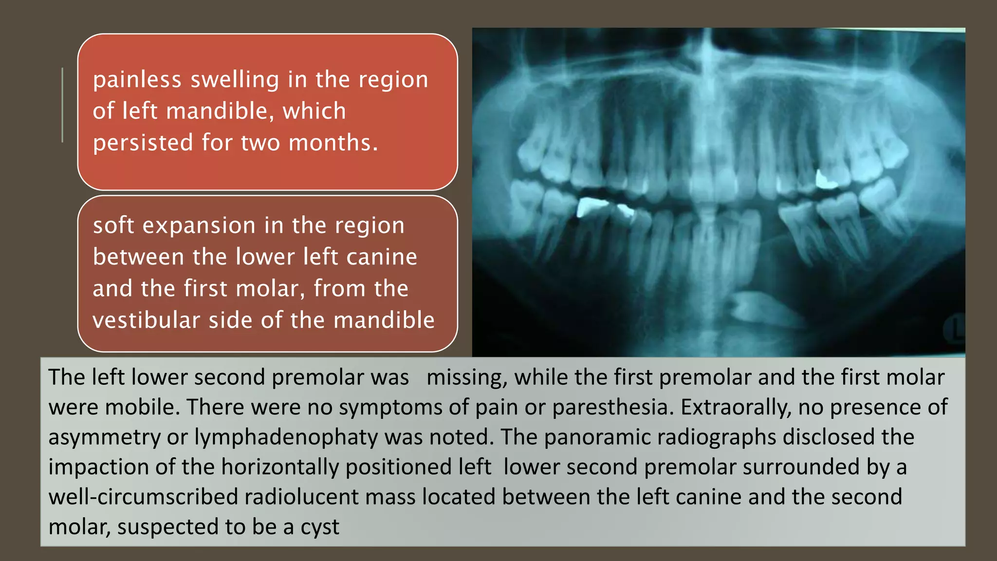 Jc cyst vs implant | PPTX