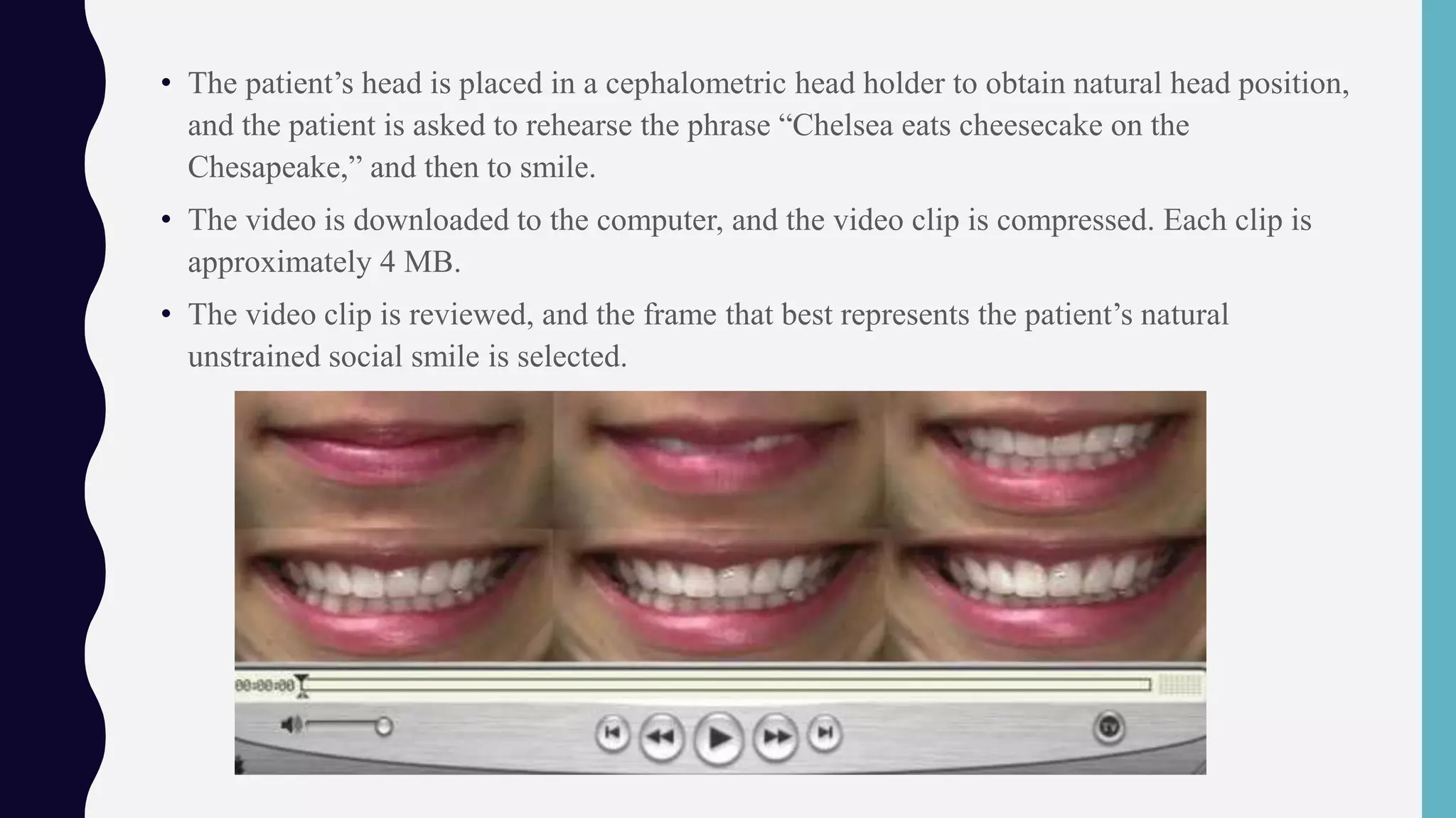 DYNAMIC SMILE ASSESSMENT | PPTX