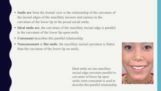 DYNAMIC SMILE ASSESSMENT | PPTX