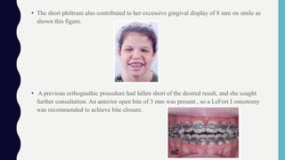 DYNAMIC SMILE ASSESSMENT | PPTX