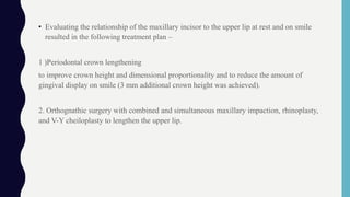 DYNAMIC SMILE ASSESSMENT | PPTX