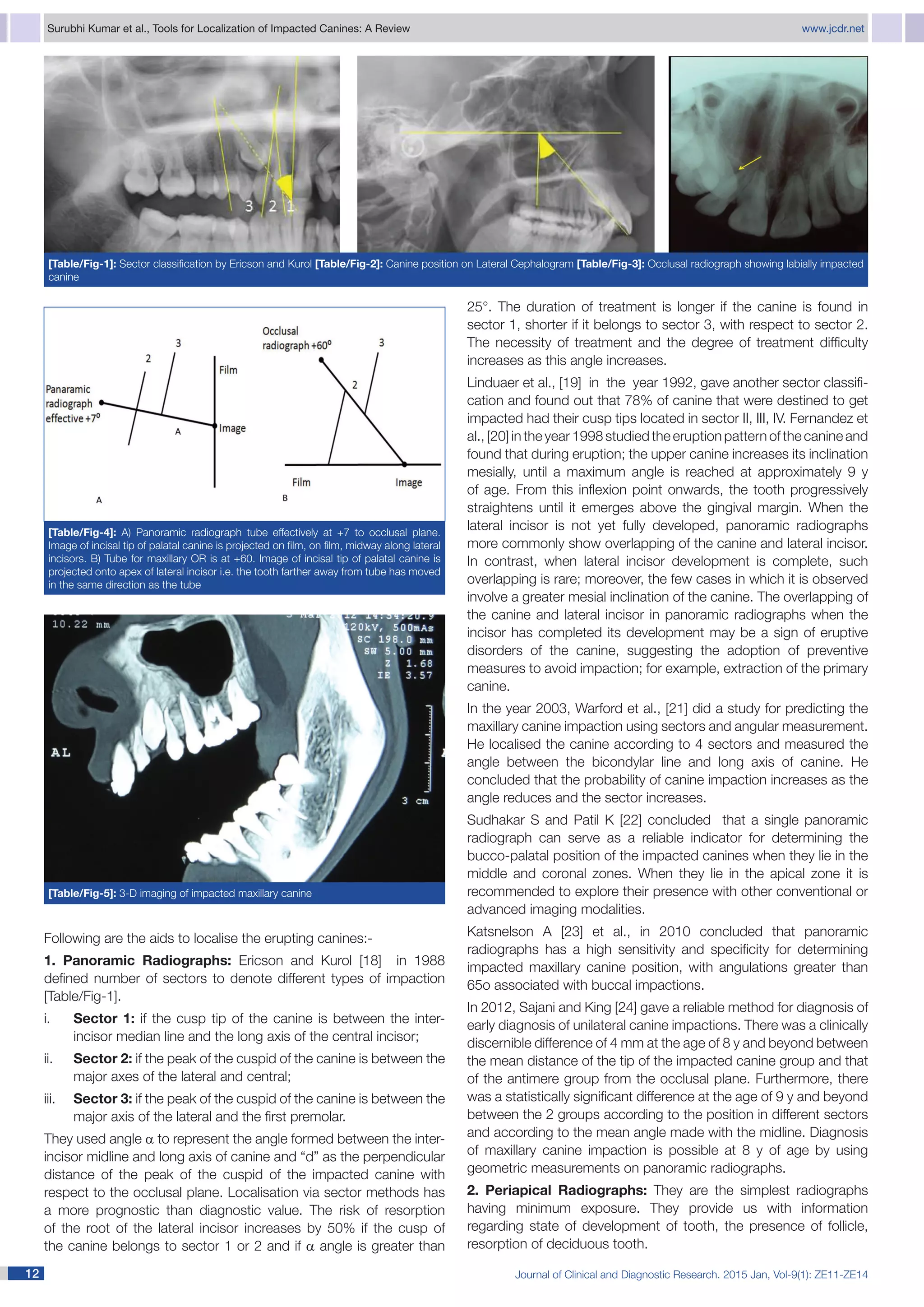 localisation of impacted canine | PDF