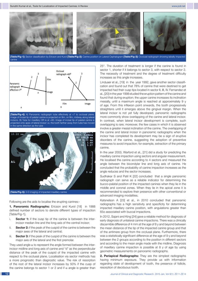 localisation of impacted canine | PDF