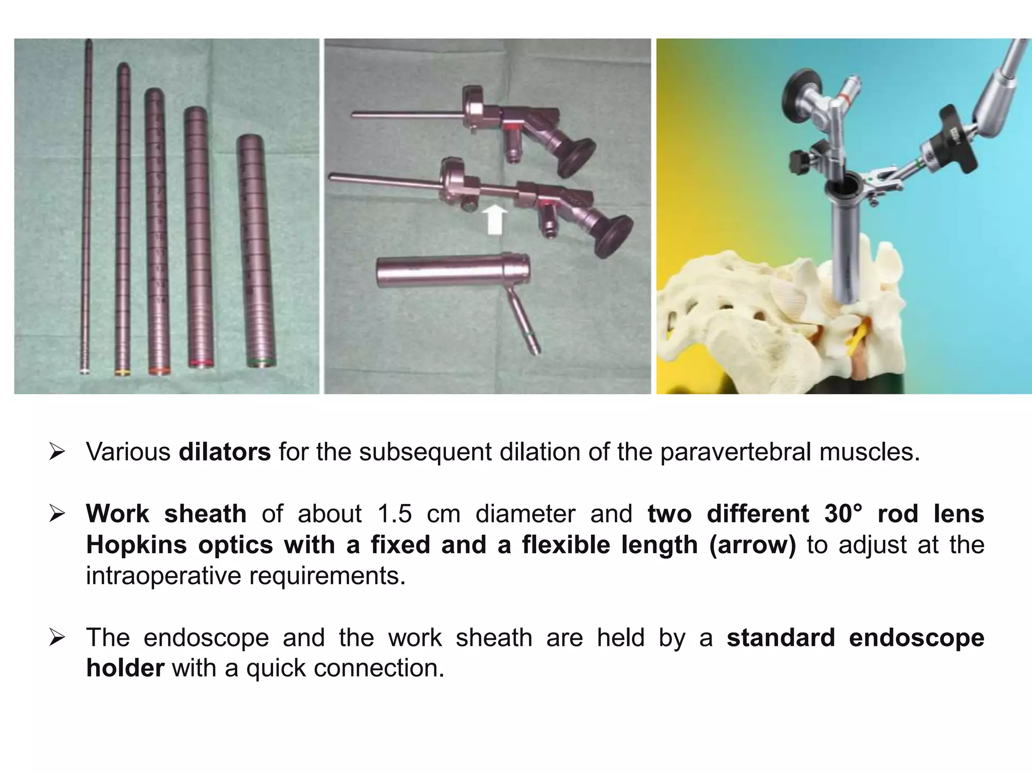 endospine easygo system.pptx
