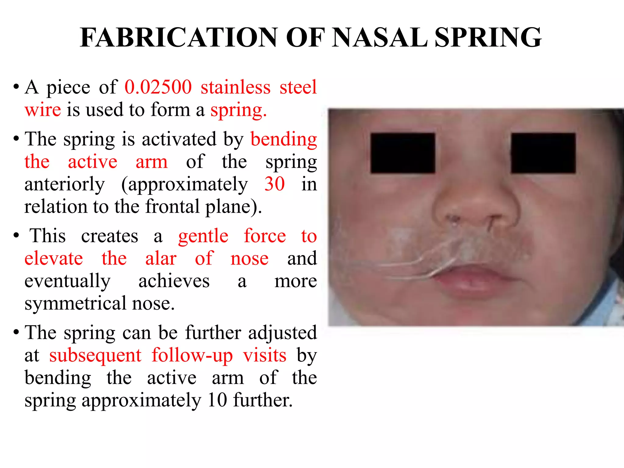 nasoalveolar molding | PPTX
