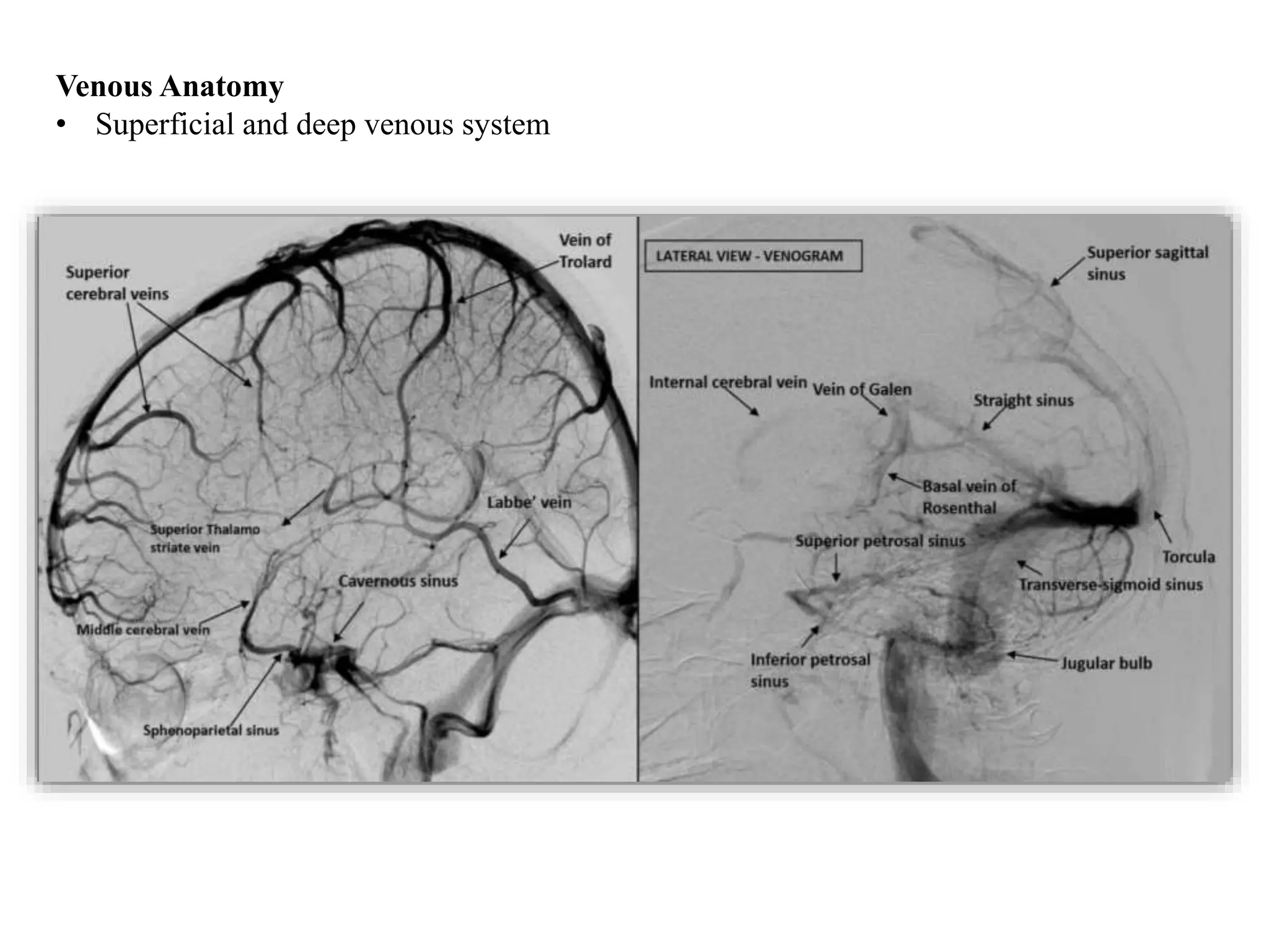 Digital Subtraction Neuroangiography: What a Resident Should Know | PPTX