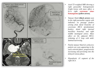 Digital Subtraction Neuroangiography: What a Resident Should Know | PPT