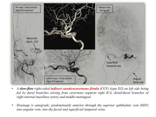 Digital Subtraction Neuroangiography: What a Resident Should Know | PPT