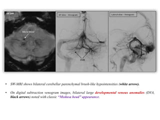 Digital Subtraction Neuroangiography: What a Resident Should Know | PPT