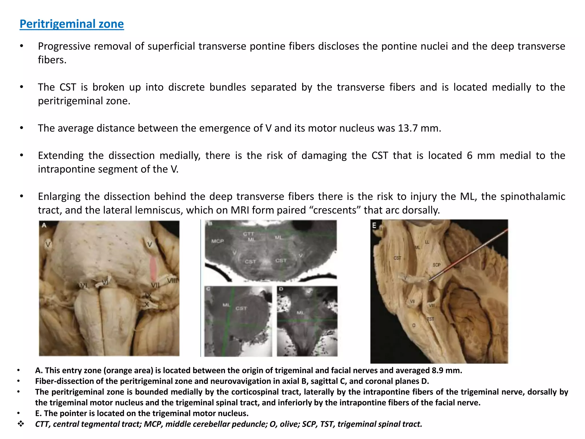 Endoscopic Endonasal Transclival Approach to the Ventral Brainstem | PPT