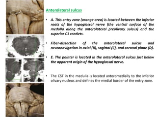 Endoscopic Endonasal Transclival Approach to the Ventral Brainstem | PPT