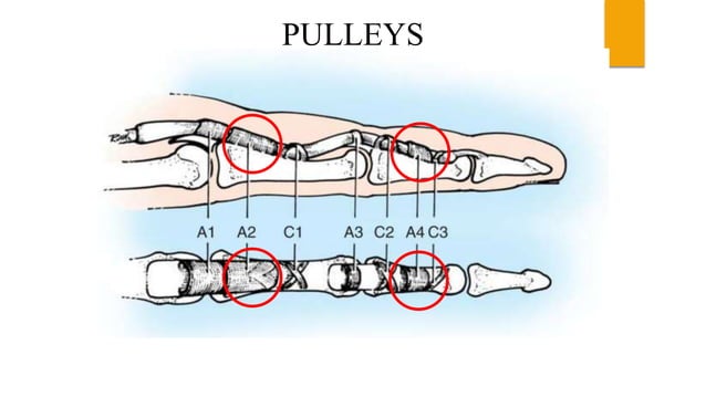 Jc flexor tendon injury, repair & rehabilitaion | PPTX