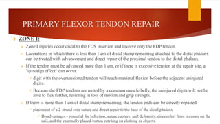 Jc flexor tendon injury, repair & rehabilitaion | PPTX