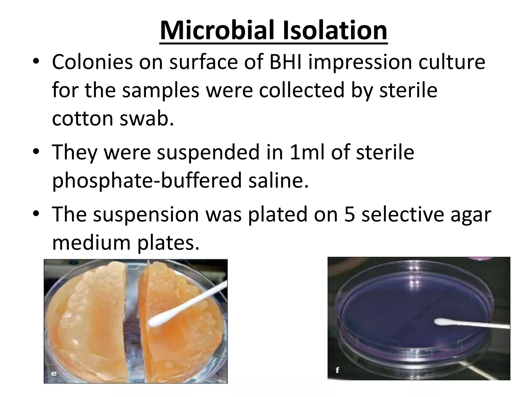 Jc impression disinfection | PPTX