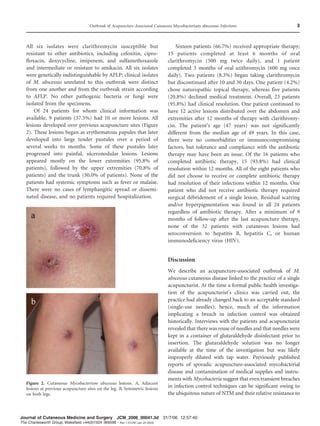 Acupuncture - | PDF