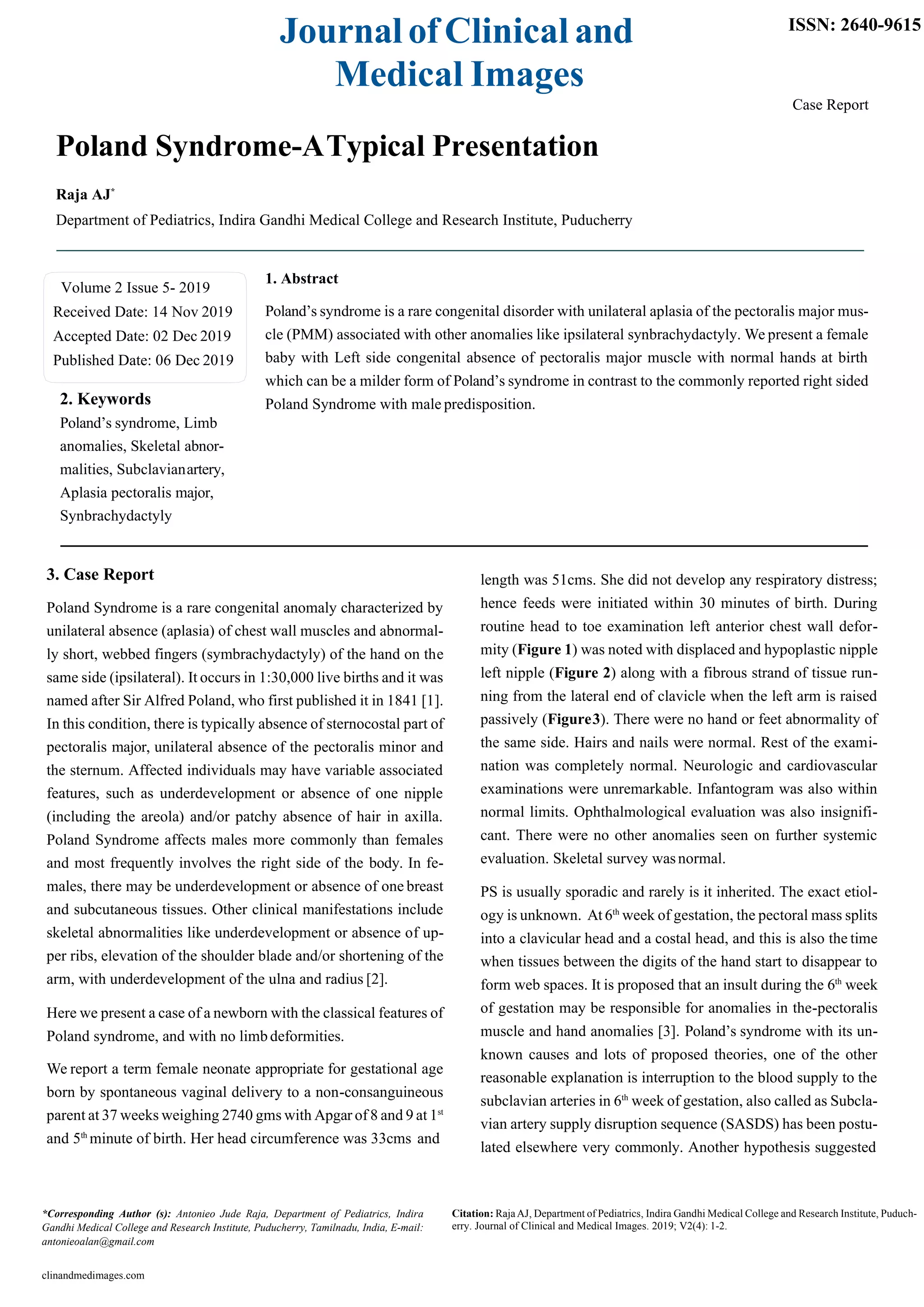 Poland Syndrome-A Typical Presentation | PDF