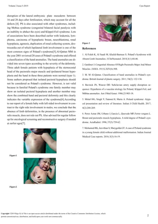 Poland Syndrome-A Typical Presentation | PDF