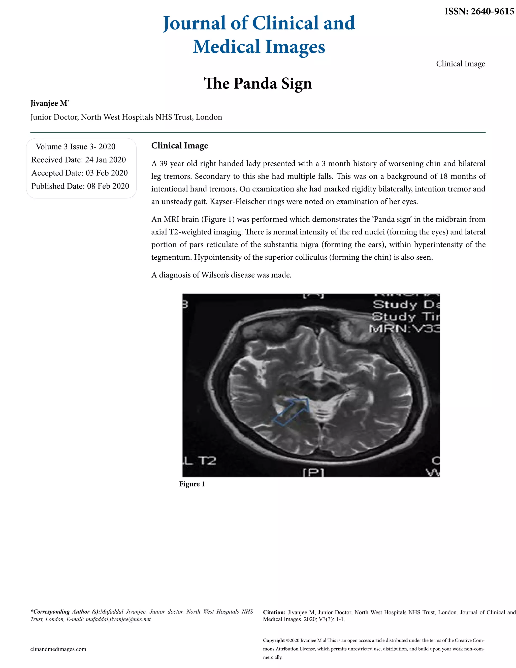 The Panda Sign | PDF
