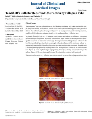 Tenckhoff ’s Catheter Recurrent Obstruction by Fallopian Tube | PDF