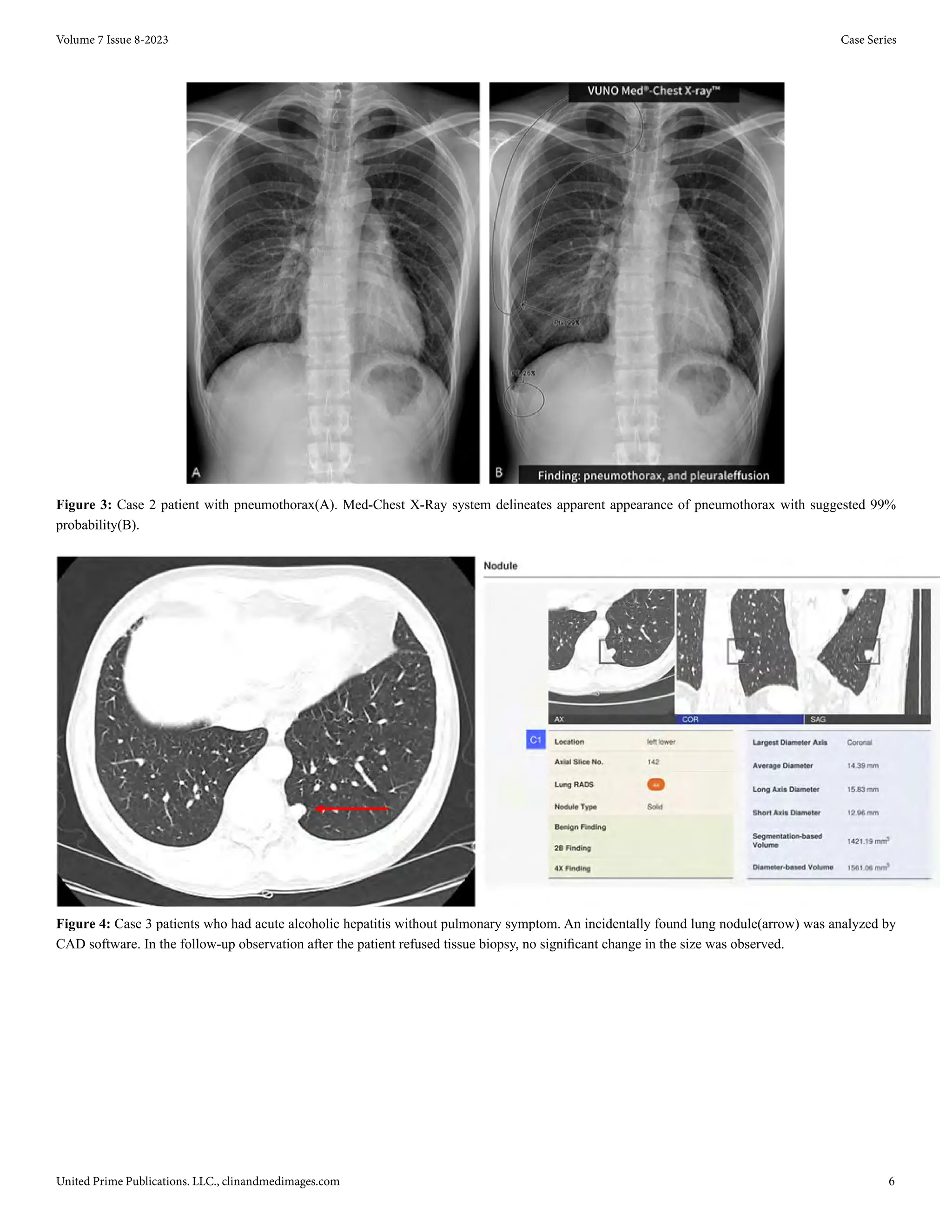 The Clinical use of Artificial Intelligence in the Analysis of Chest Radiographs and Computed ...