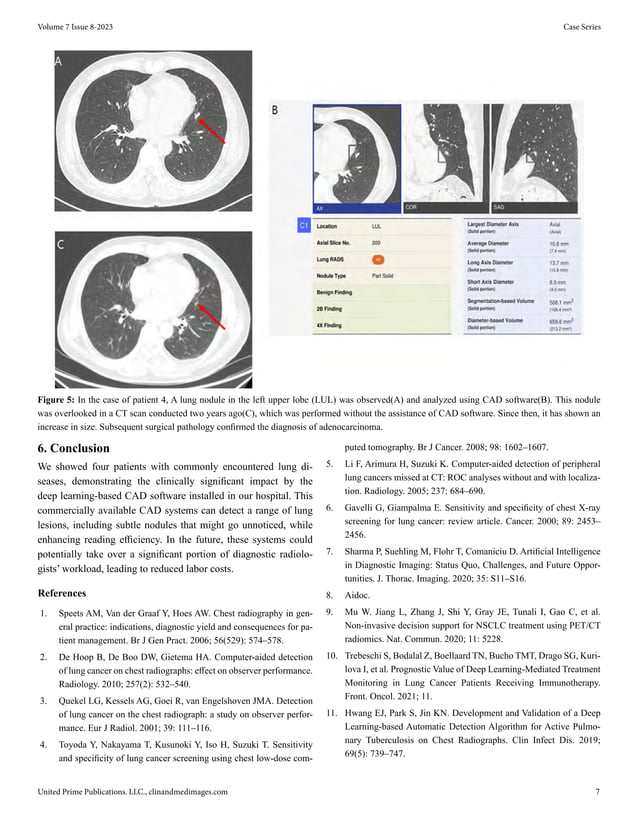The Clinical use of Artificial Intelligence in the Analysis of Chest Radiographs and Computed ...