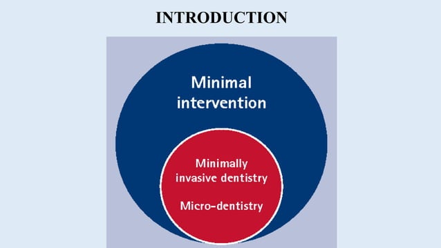 Minimal Intervention Dentistry | PPTX