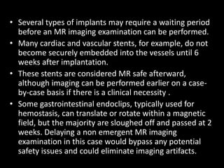 MRI safety | PPTX