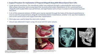Regenerative Nanotechnology in Oral and Maxillofacial Surgery | PPT