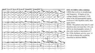 ACNS Standardized Critical Care EEG Terminology 2021 | PDF