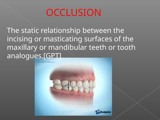 jcocclusionindicators-190420143826.pptxdfgfdesw | PPTX