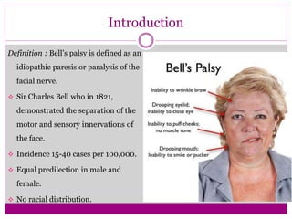jc on bells palsy.pptx
