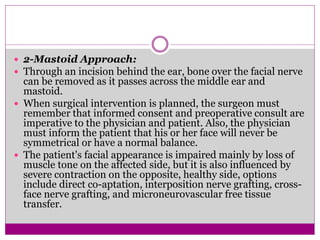 jc on bells palsy.pptx