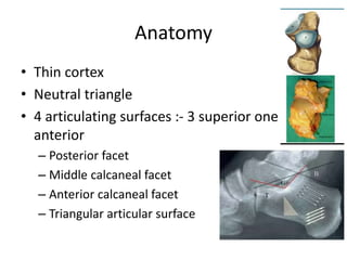 JC on CALCANEUM FRACTURE | PPT