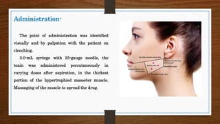 JC on Intramuscular injection of botox for massetric hypertrophy | PPTX