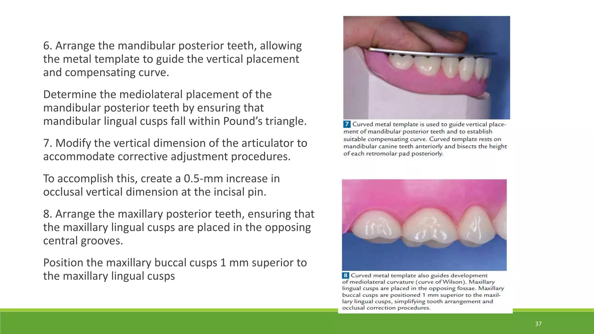 JOURNAL CLUB PRESENTATION on lingualised occlusion | PDF