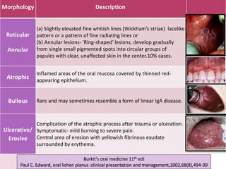 Jc on oral lichen planus | PPTX
