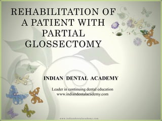 partial glossectomy/ online orthodontic courses | PPTX