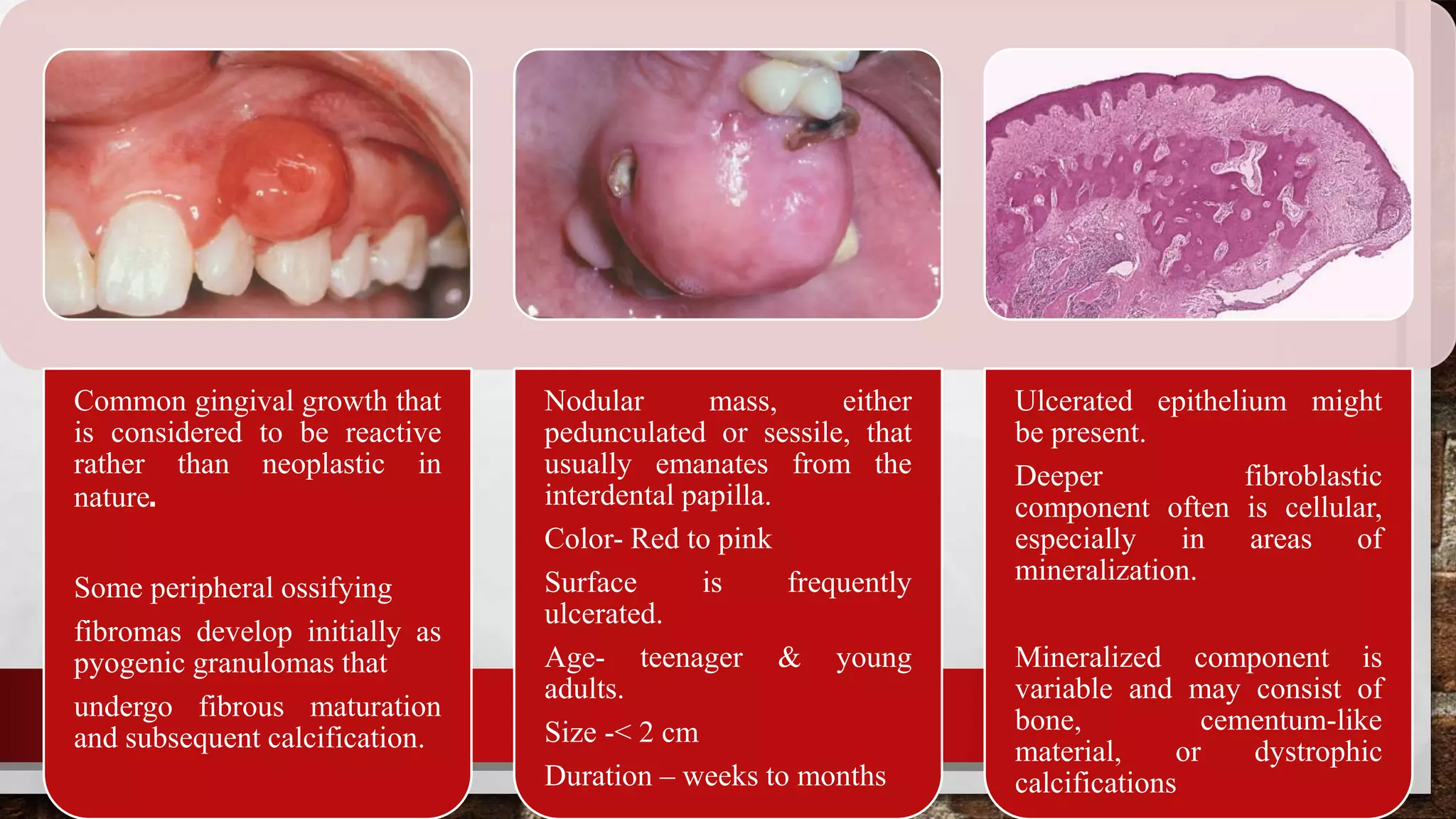 Jc peipheral exophytic growth ppt | PPTX
