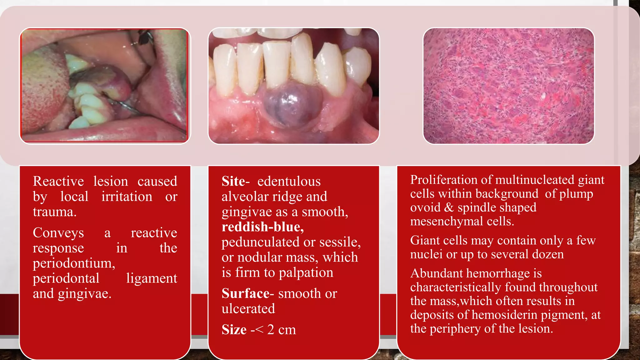 Jc peipheral exophytic growth ppt | PPTX