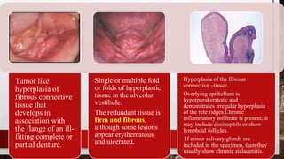 Jc peipheral exophytic growth ppt | PPTX