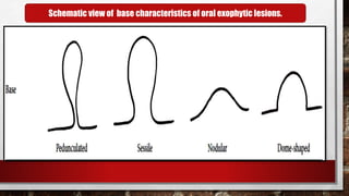 Jc peipheral exophytic growth ppt | PPTX