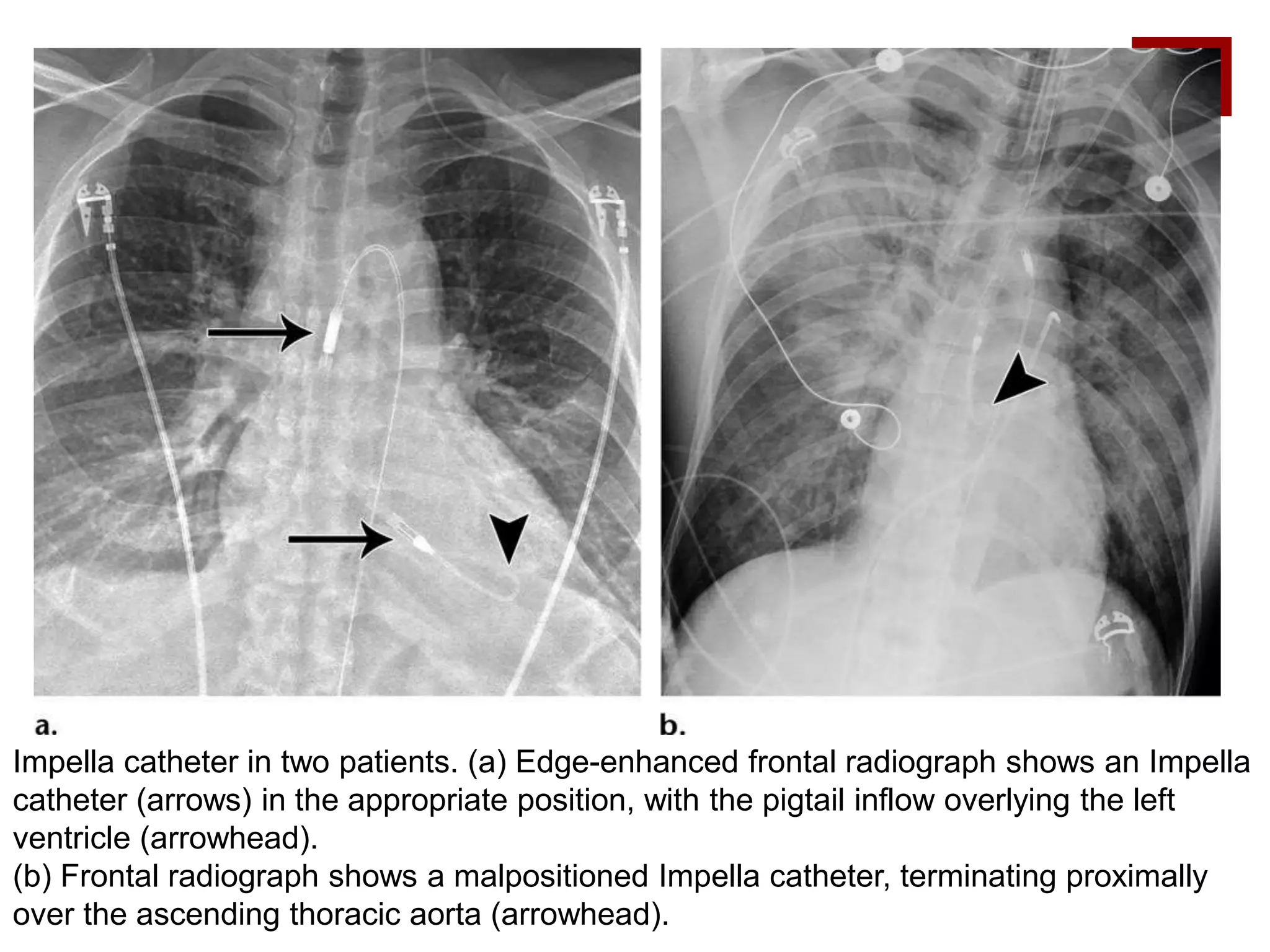 Radiographic Review of Current Therapeutic and Monitoring Devices in ...