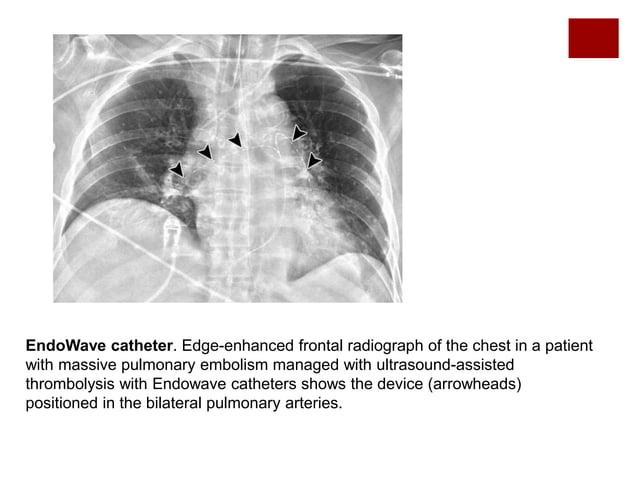 Radiographic Review of Current Therapeutic and Monitoring Devices in ...