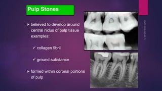 Jc review pulp stone | PPT