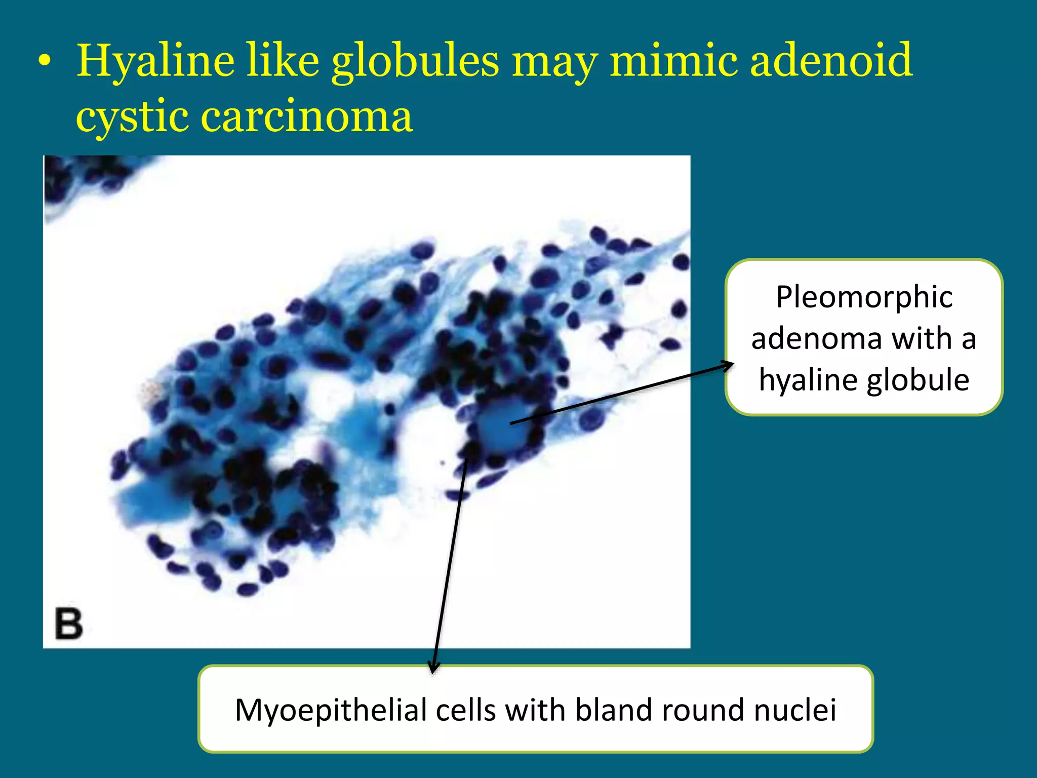 Jc salivary glands | PPTX