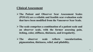 journal club - scar revision with laser and narrowband intensed pulsed ...