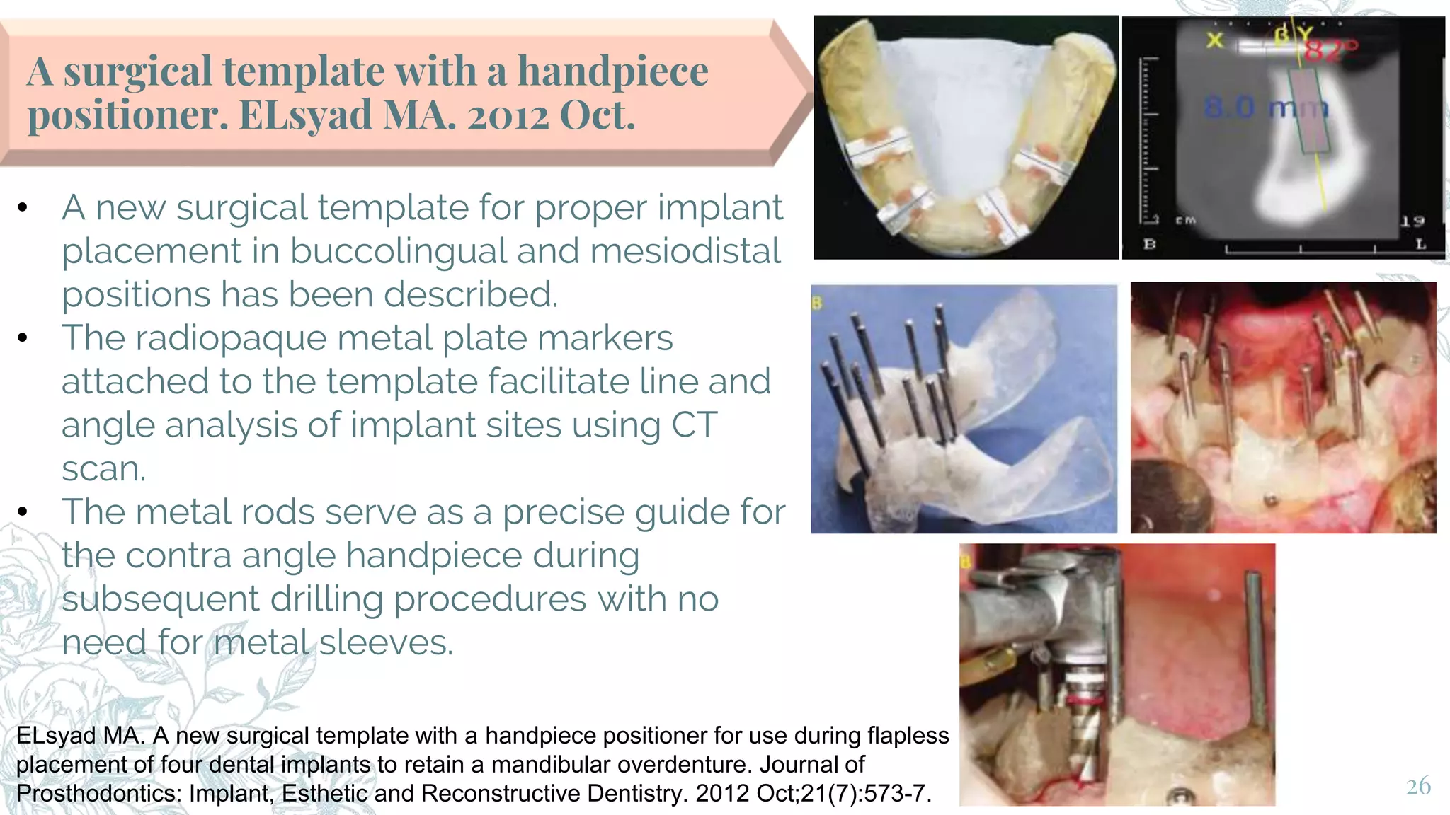 Surgical guide_ journal club | PPTX